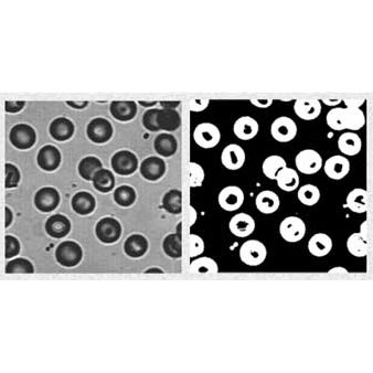 MATLAB code: Image Segmentation using Artificial Neural Network - digitfile